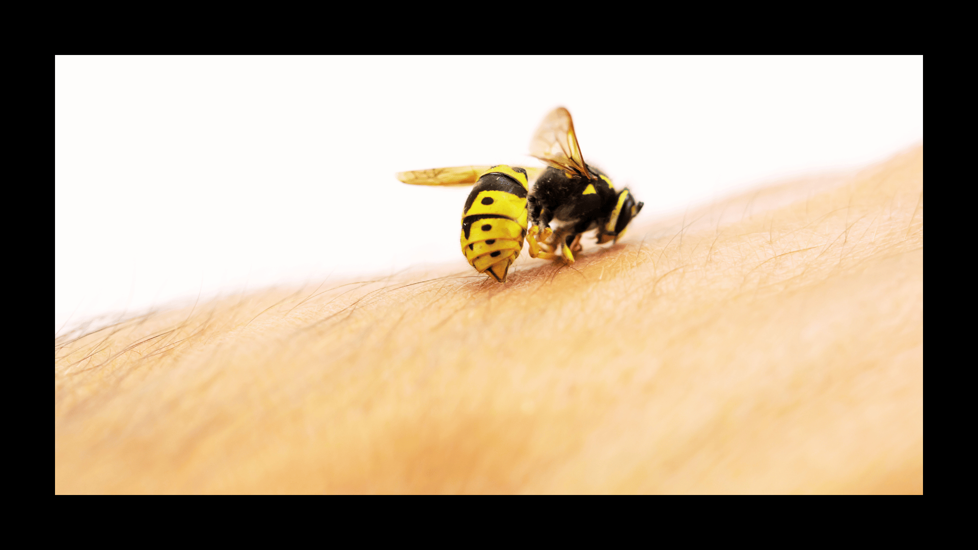 Intriguing Insights: Why Do Bees Sting If It Kills Them? A Deadly Dilemma!